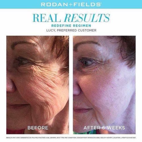 20 Rodan and Fields Before and After Pictures That Will Shock You - The ...