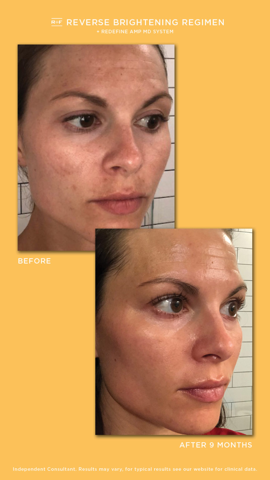 20 Rodan and Fields Before and After Pictures That Will Shock You - The ...