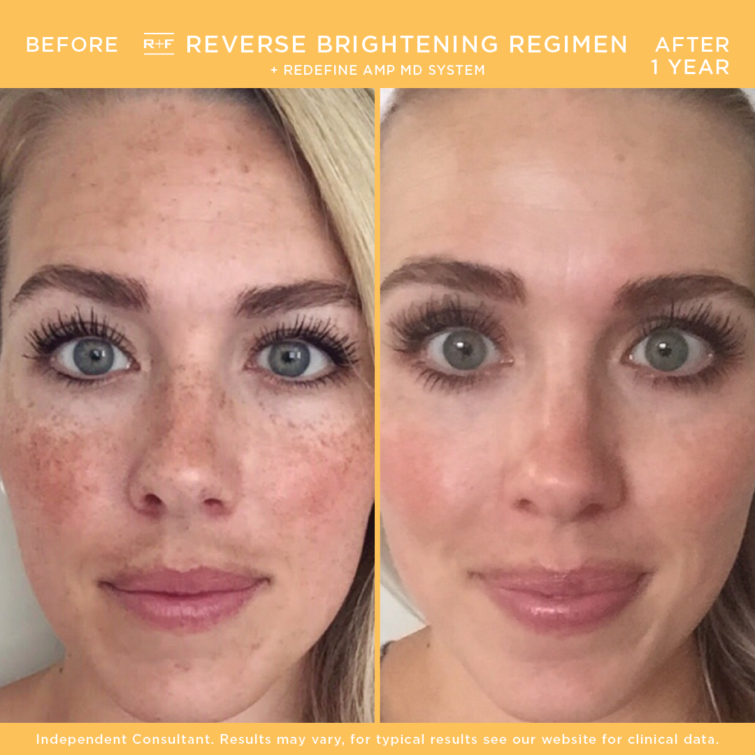 20 Rodan and Fields Before and After Pictures That Will Shock You - The ...